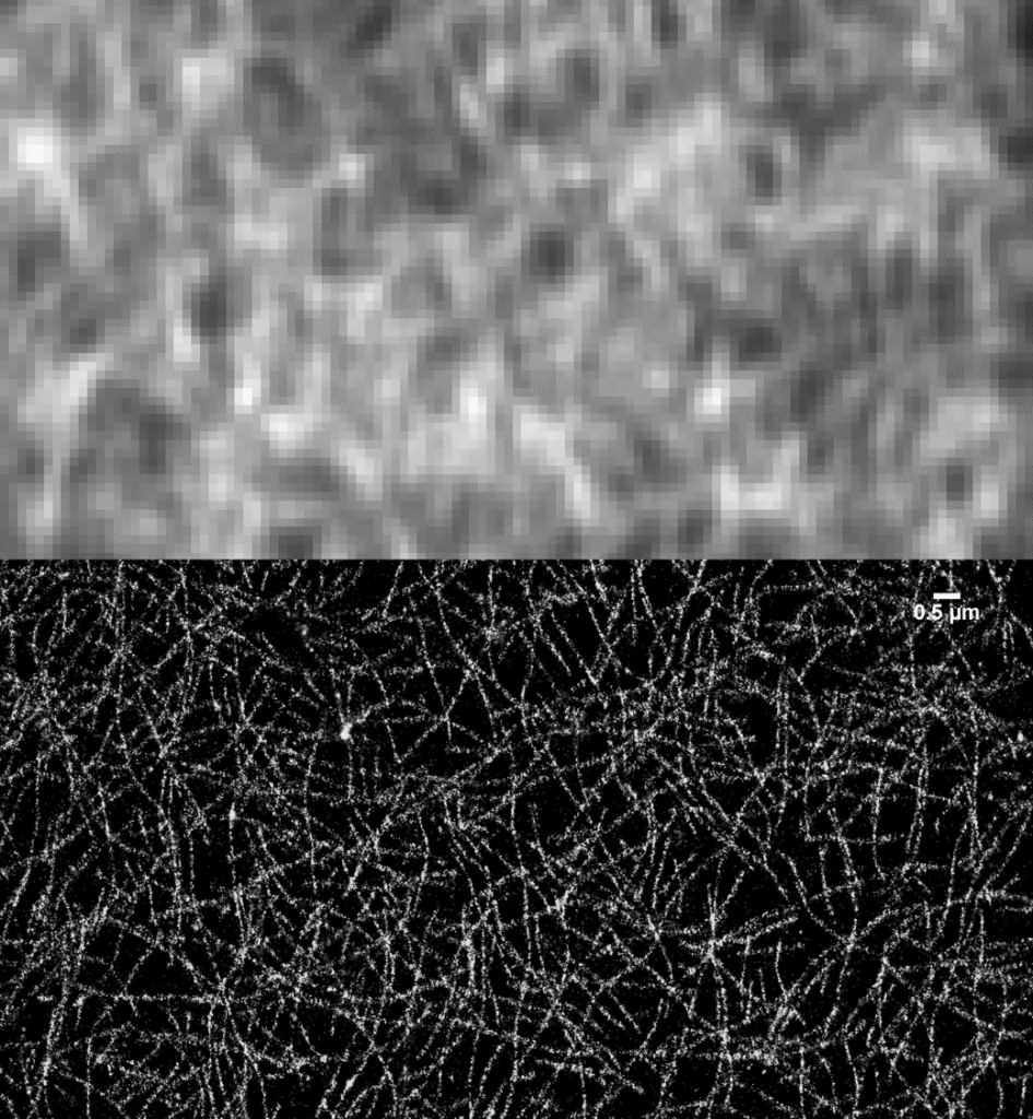 STORM Microscopy | Warshaw Laboratory – University of Vermont
